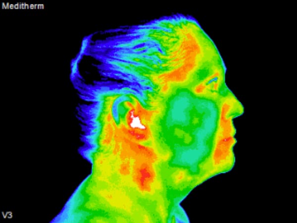 Digital Infrared Thermal Imaging Services - Oregon Thermography